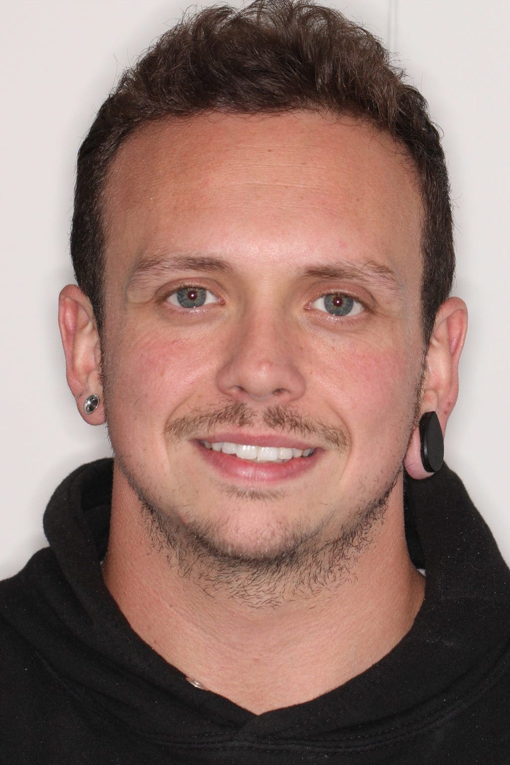 Dentist in Wadebridge Cornwall | Award Winning Dental Practice